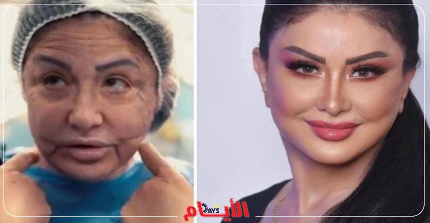 بعد تشوه وجهها وفاء سالم تخطف الأنظار في أحدث ظهور لها لن تصدق شكلها فن الأيام